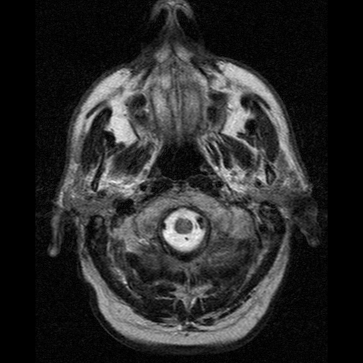 BioNeuralNetwork - MRI AI Analysis Startup